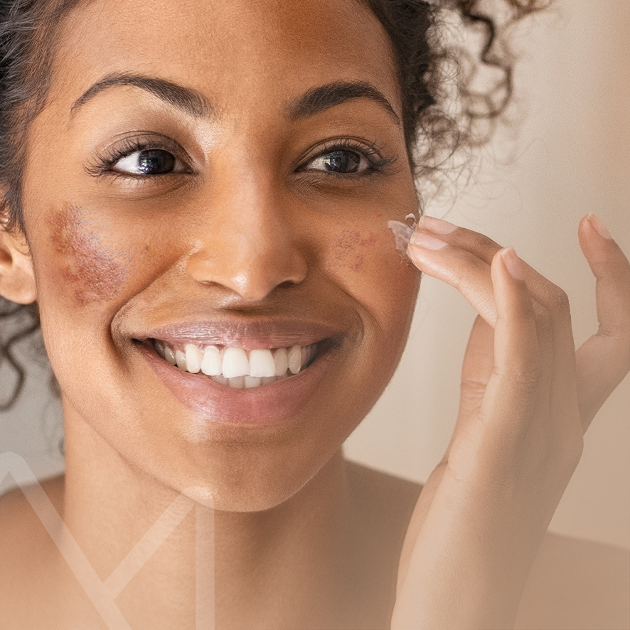 Bioplacenta: tudo o que você precisa saber sobre este extrato biológico ...